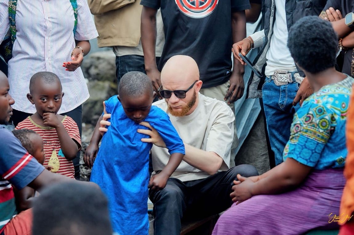 Goma : Yvon Yusuf en casquette d’humanitaire avec son projet « Akuna ...